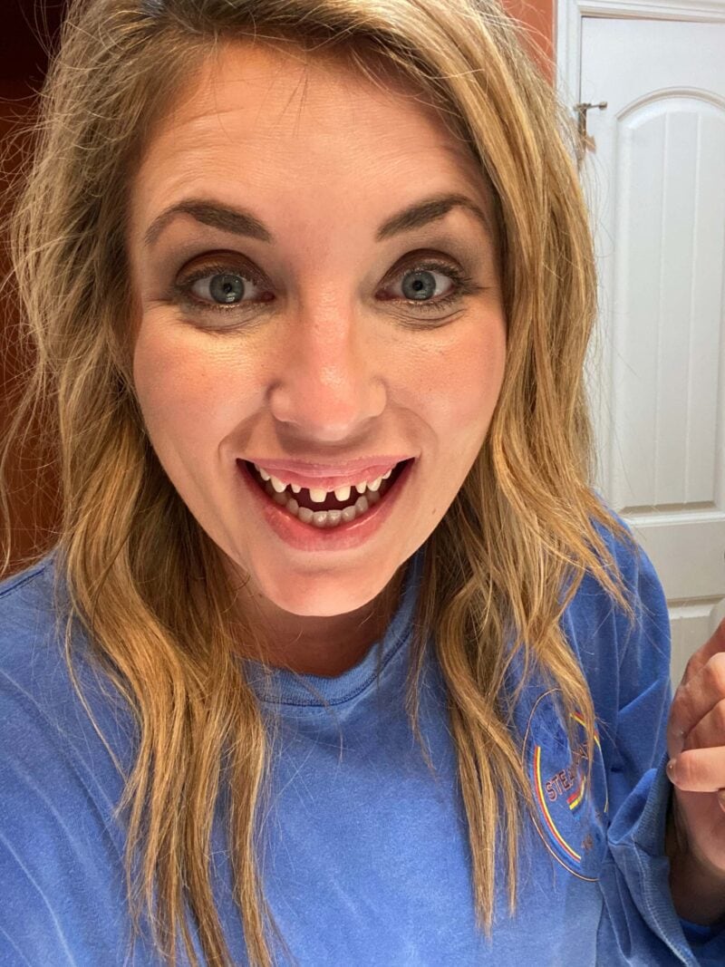 Emily Luck - My Teeth Saga - The Journey of Parenthood...