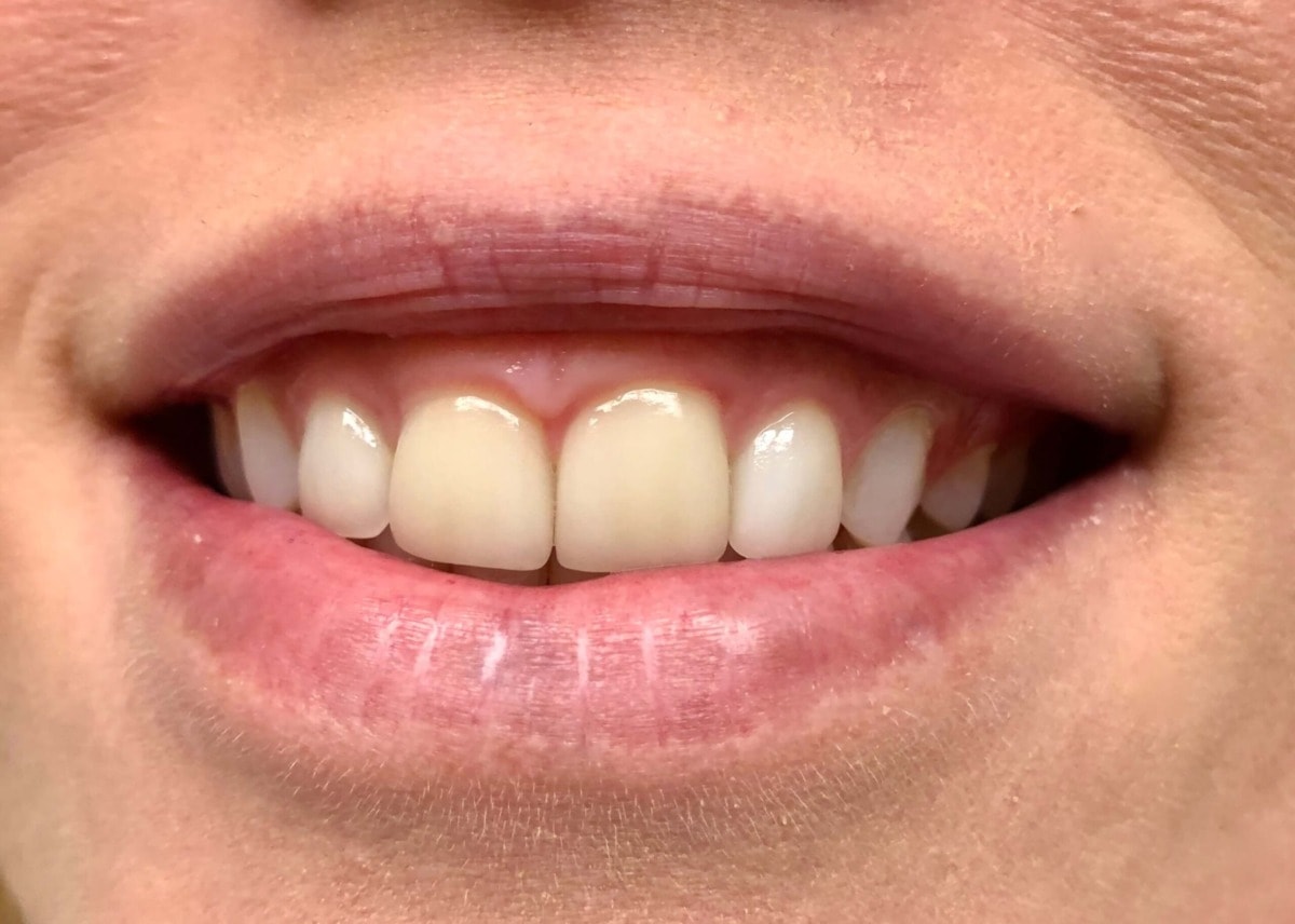 Emily Luck - My Teeth Saga - The Journey of Parenthood...