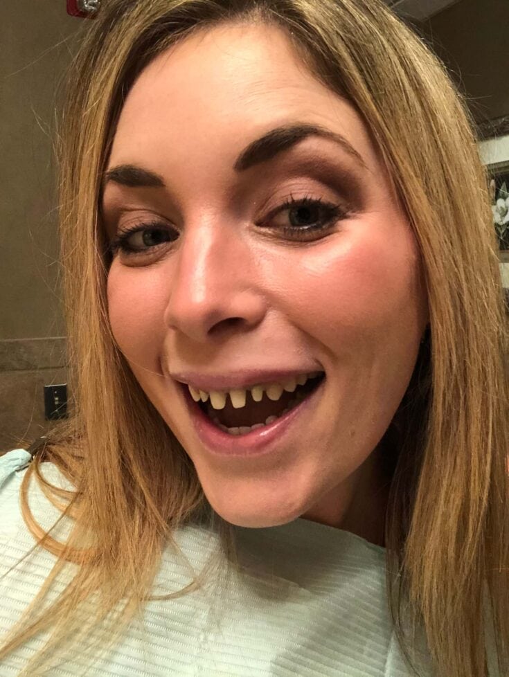 Emily Luck - My Teeth Saga - The Journey of Parenthood...