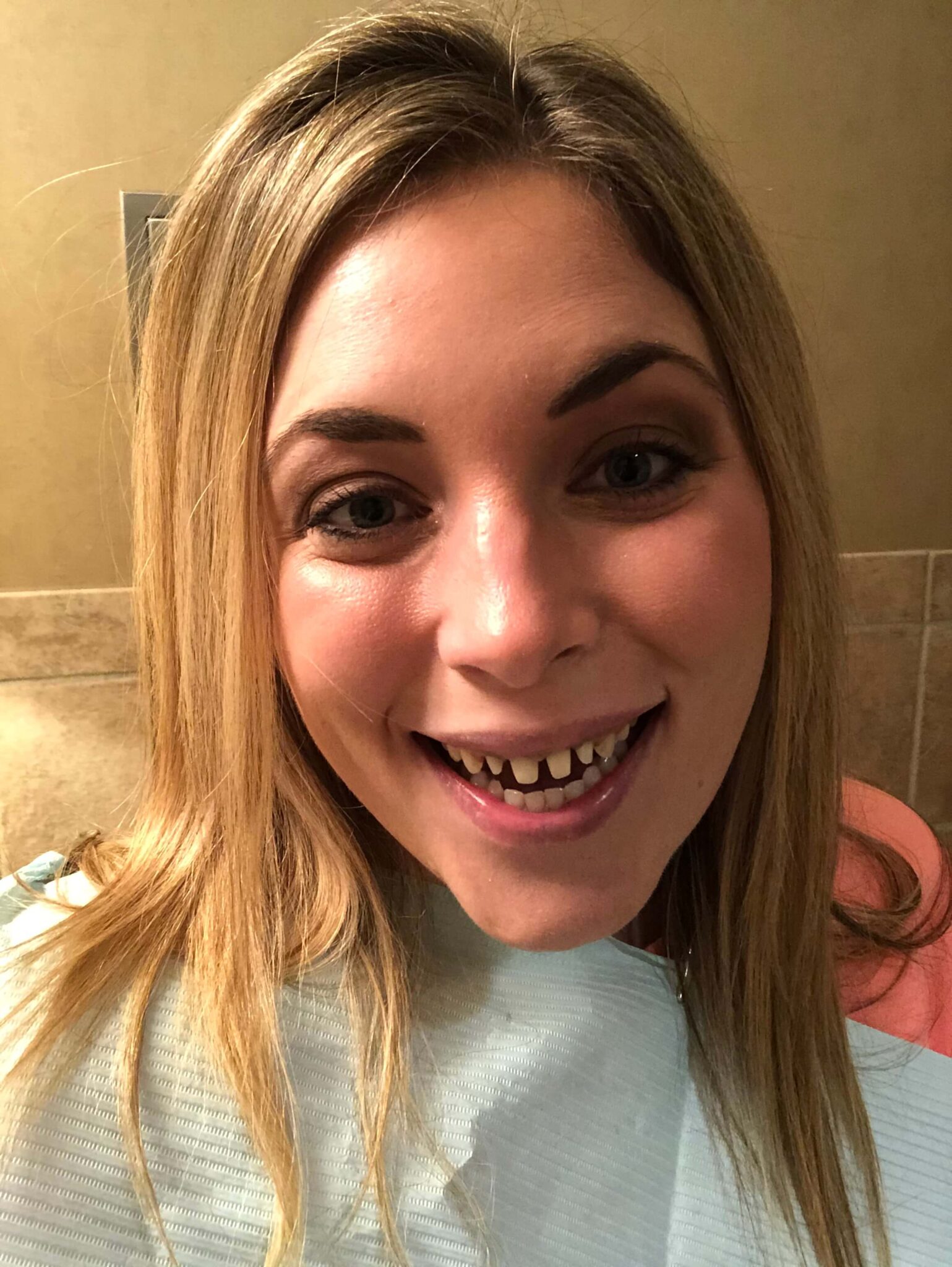 Emily Luck - My Teeth Saga - The Journey of Parenthood...