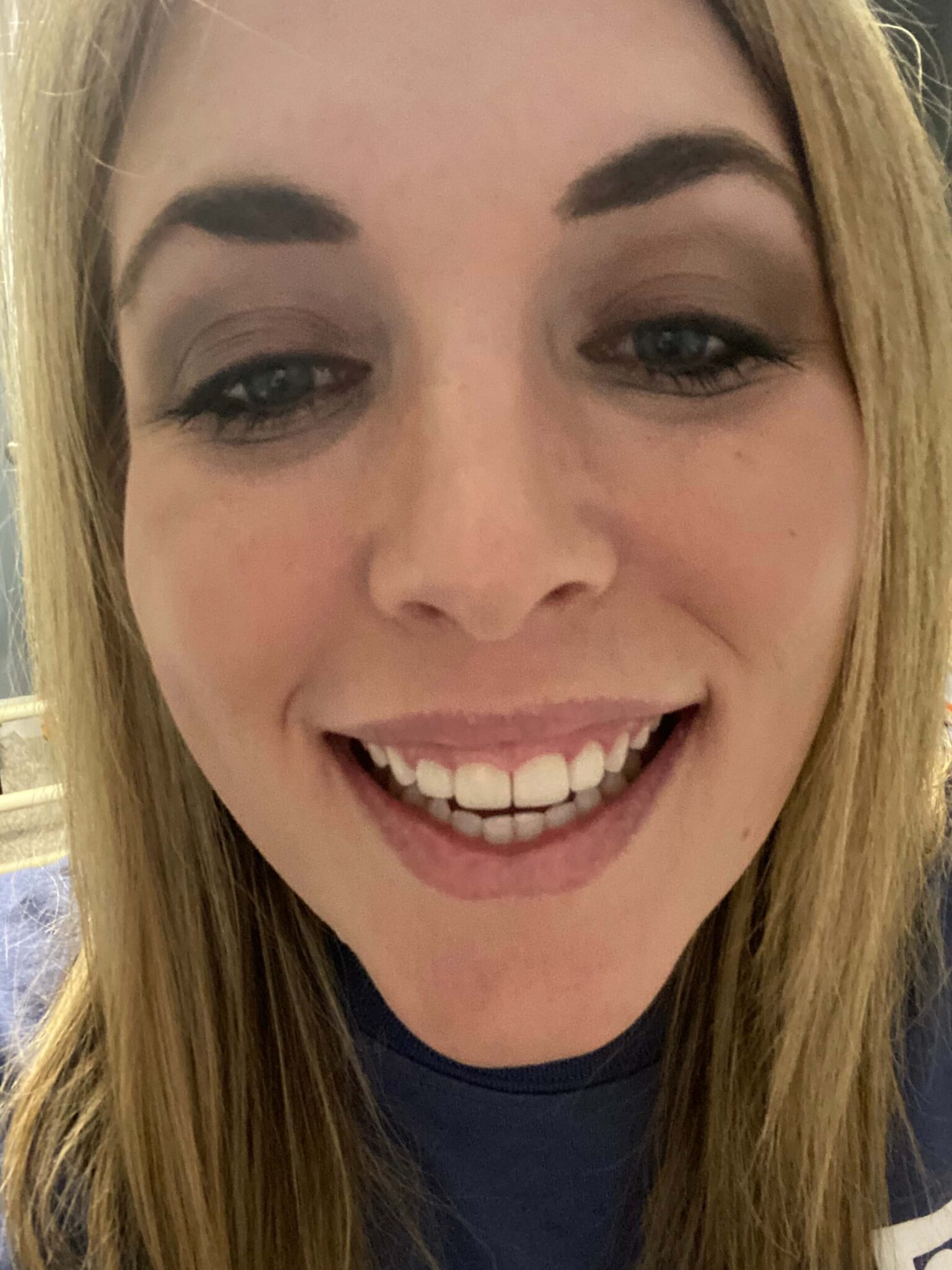 Emily Luck - My Teeth Saga - The Journey of Parenthood...