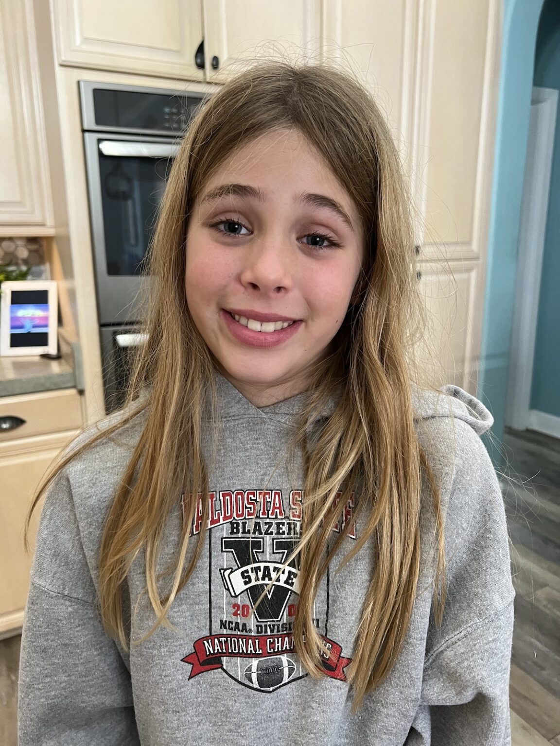 Nerf Gun Eye Injury: Child Shot in Eye with Nerf Gun? What to Do!