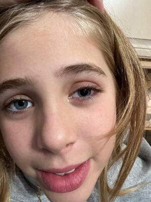 Nerf Gun Eye Injury: Child Shot in Eye with Nerf Gun? What to Do!