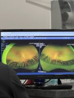 Nerf Gun Eye Injury: Child Shot in Eye with Nerf Gun? What to Do!