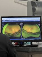 Nerf Gun Eye Injury: Child Shot in Eye with Nerf Gun? What to Do!