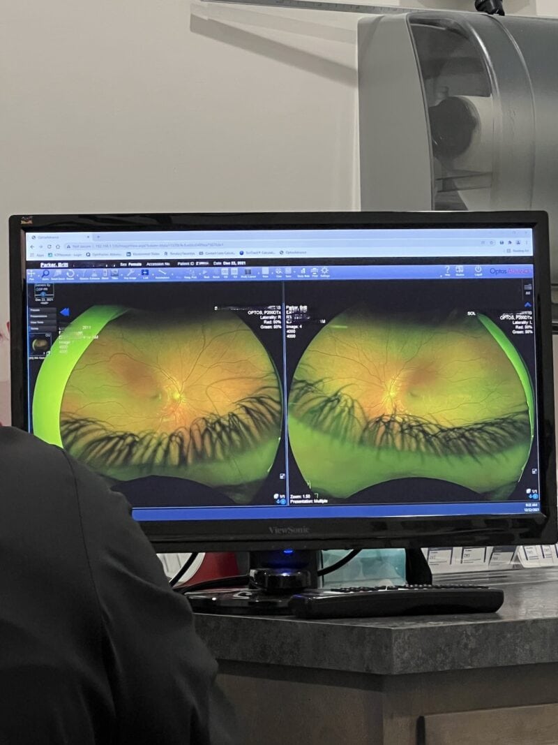 Nerf Gun Eye Injury: Child Shot in Eye with Nerf Gun? What to Do!