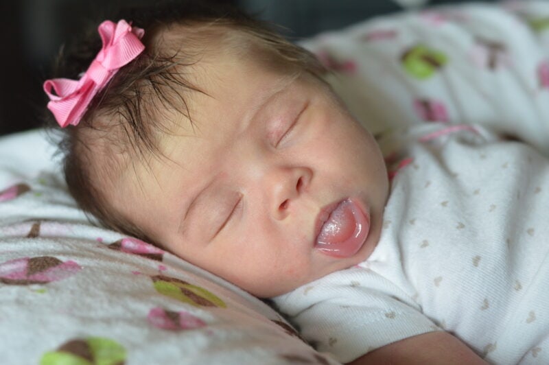 How to Prevent Thrush While Breastfeeding: Battling Thrush